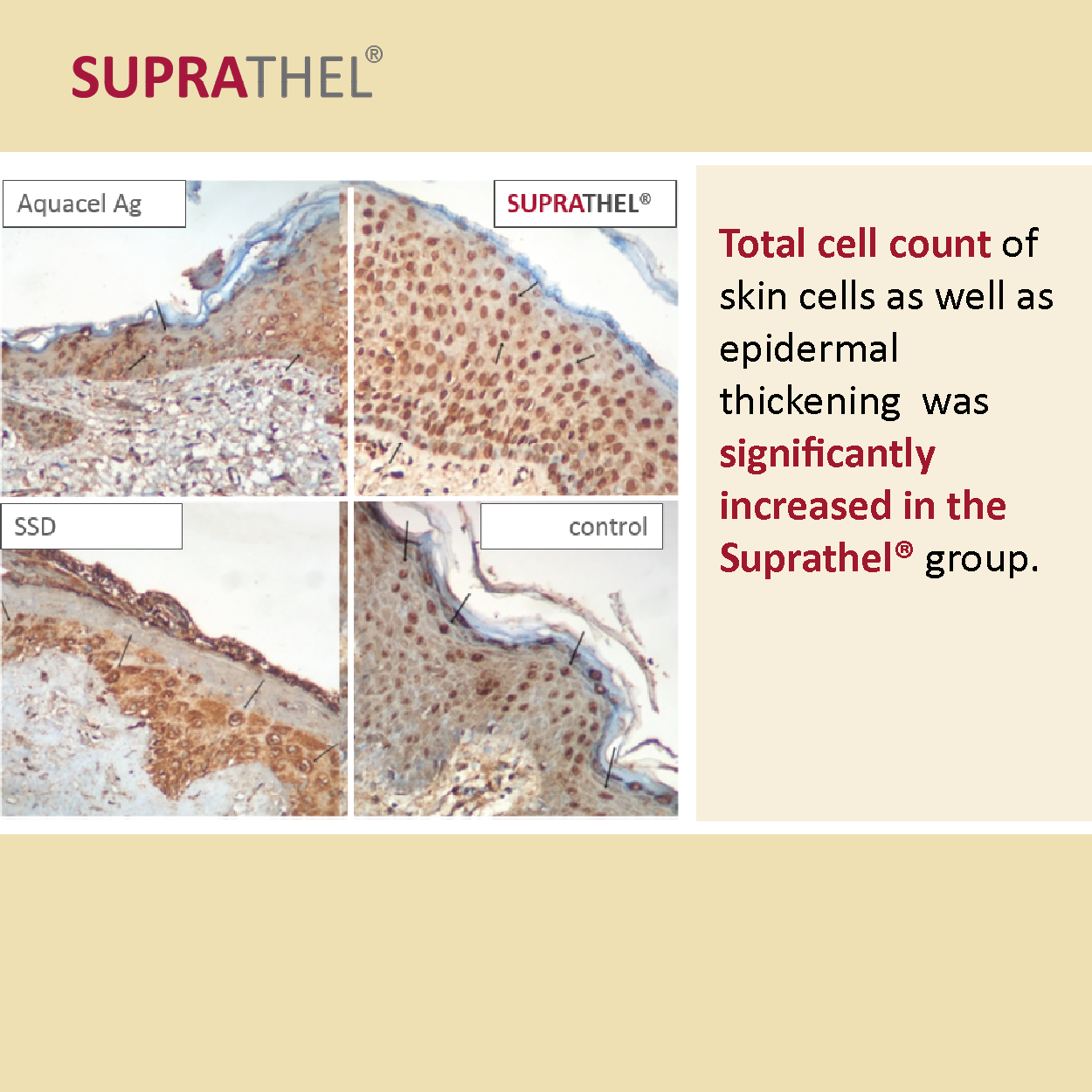 Plataforma de Formación en ventas de SUPRATHEL® – Polymedics